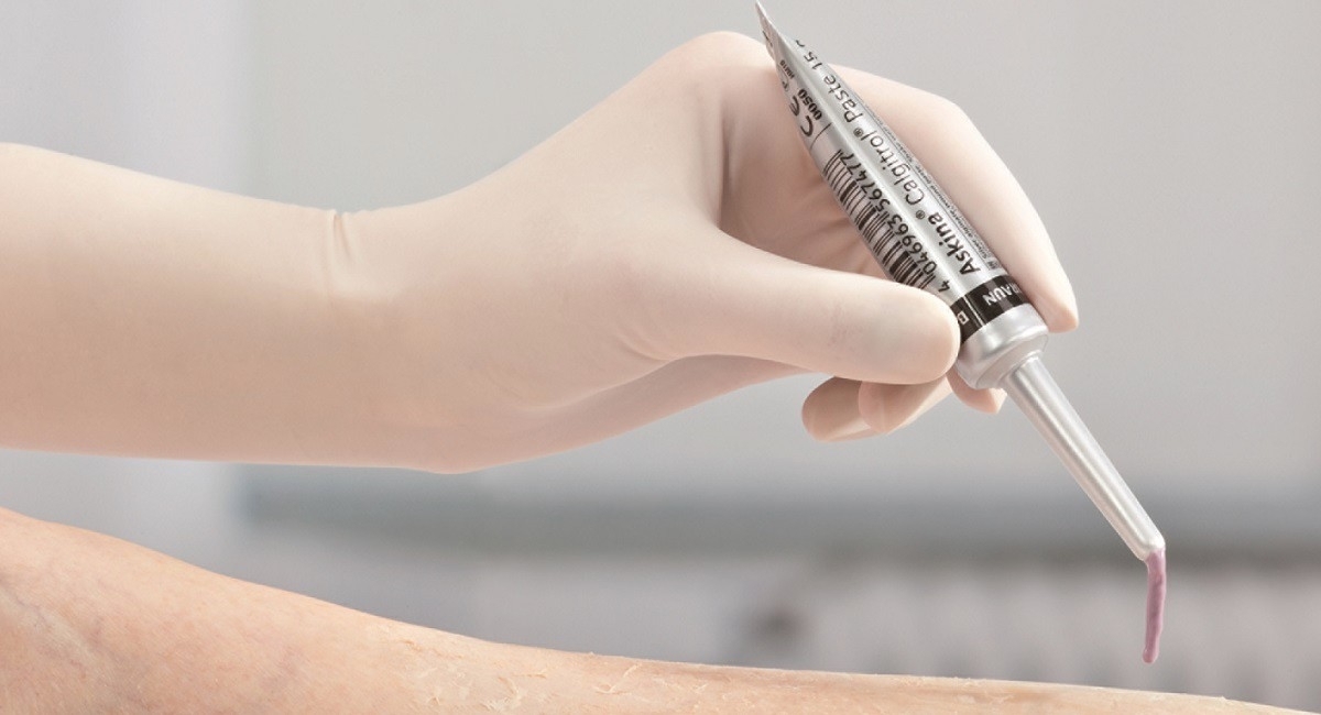 Curativo Bbraun Askina Calgitrol Paste Alginato de Cálcio e Prata